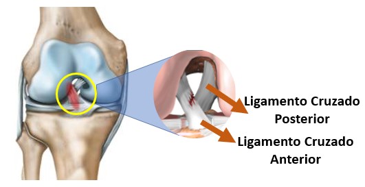 LIGAMENTO DO JOELHO - Dr. João Hollanda | Especialista em Joelho